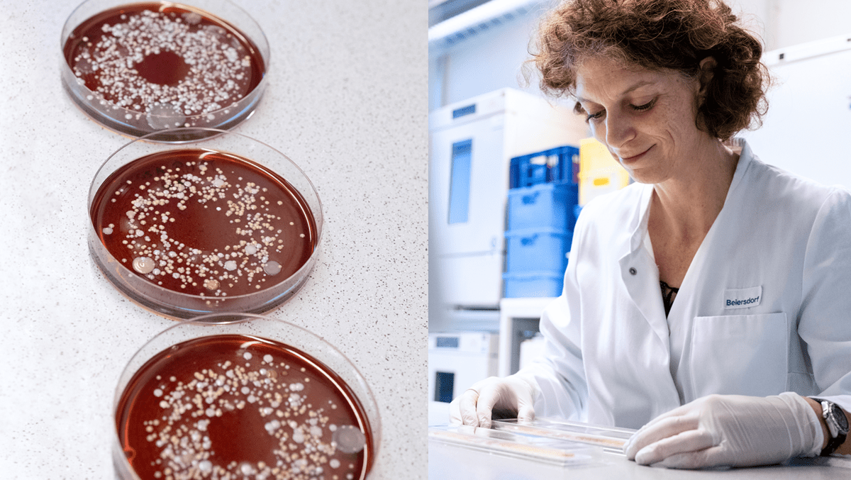 Latest research findings expand the spectrum for microbiome-based ...
